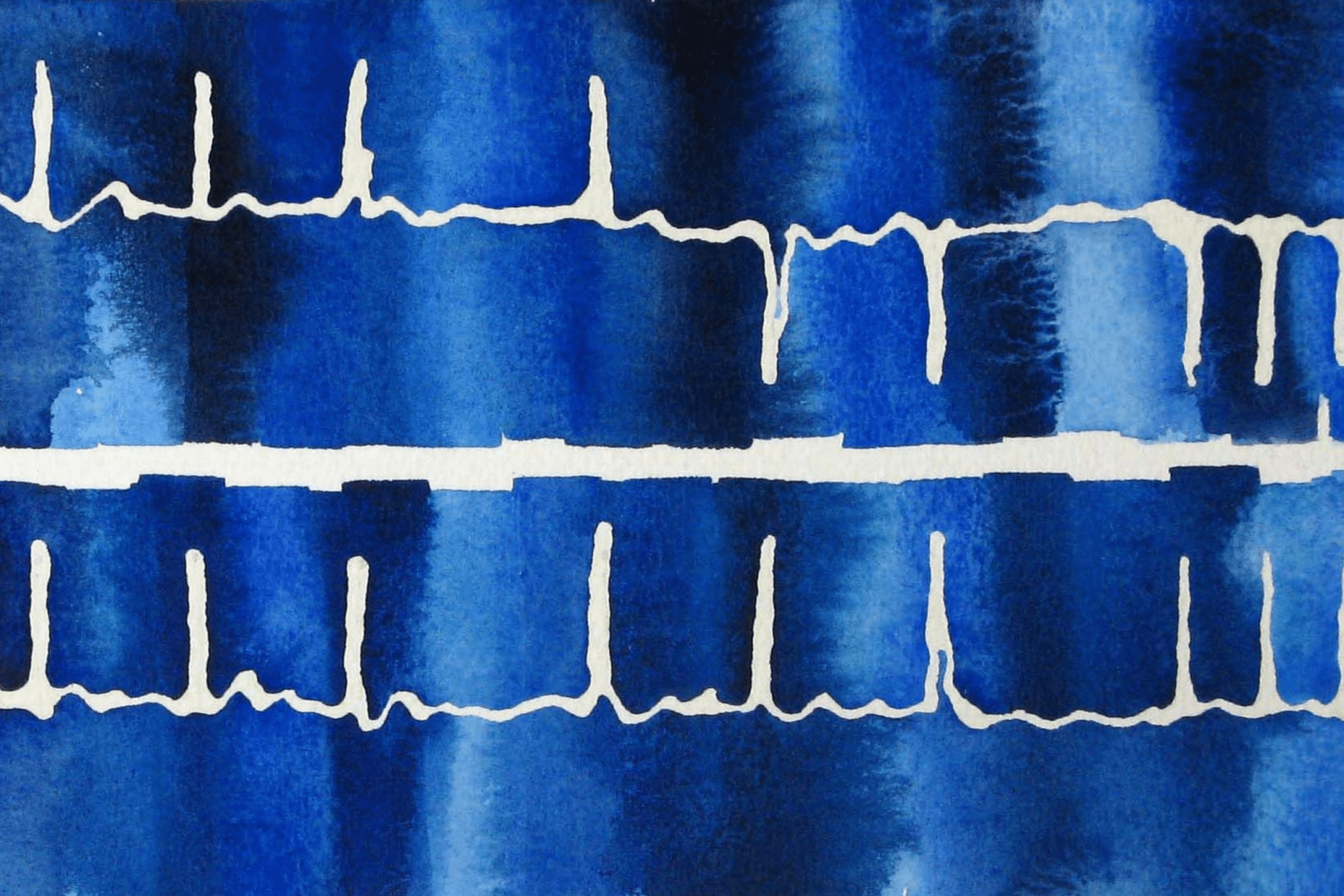 DOACs – A Simple Guide for Atrial Fibrillation & DVT - OneMedicine